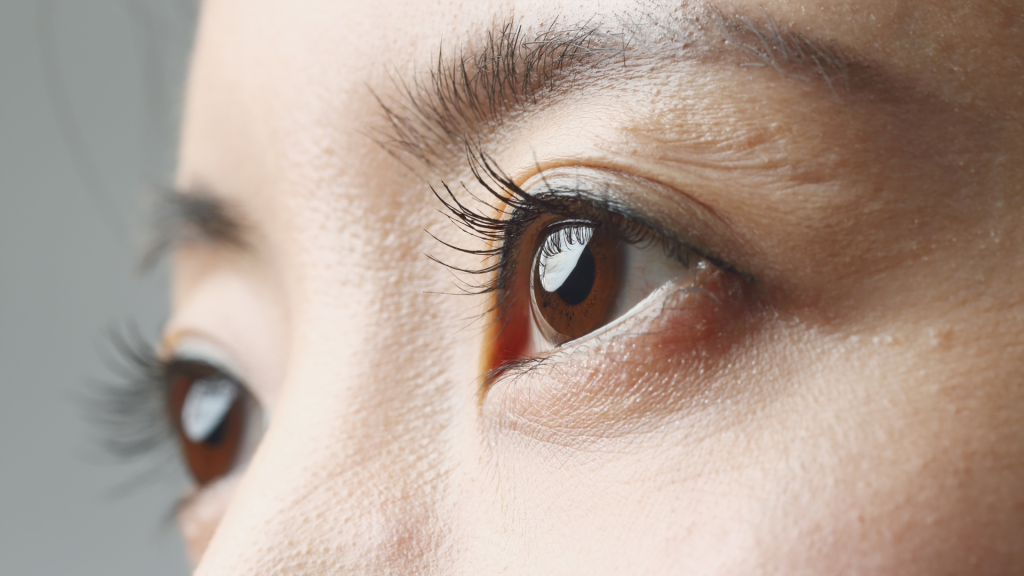 High Eyes: Causes, Signs & How to Get Rid of It